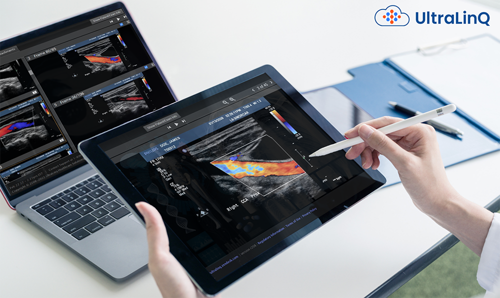 Cloud-Based PACS vs On-Site Solutions | UltraLinQ